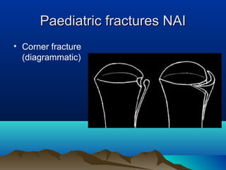 Rural Fracture Care | PPT