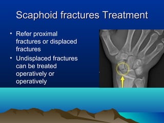 Rural Fracture Care | PPT