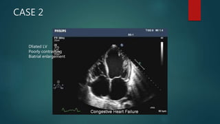 Use of bedside ultrasound in shock: RUSH protocol | PPTX