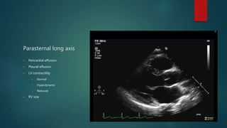 Use of bedside ultrasound in shock: RUSH protocol | PPTX