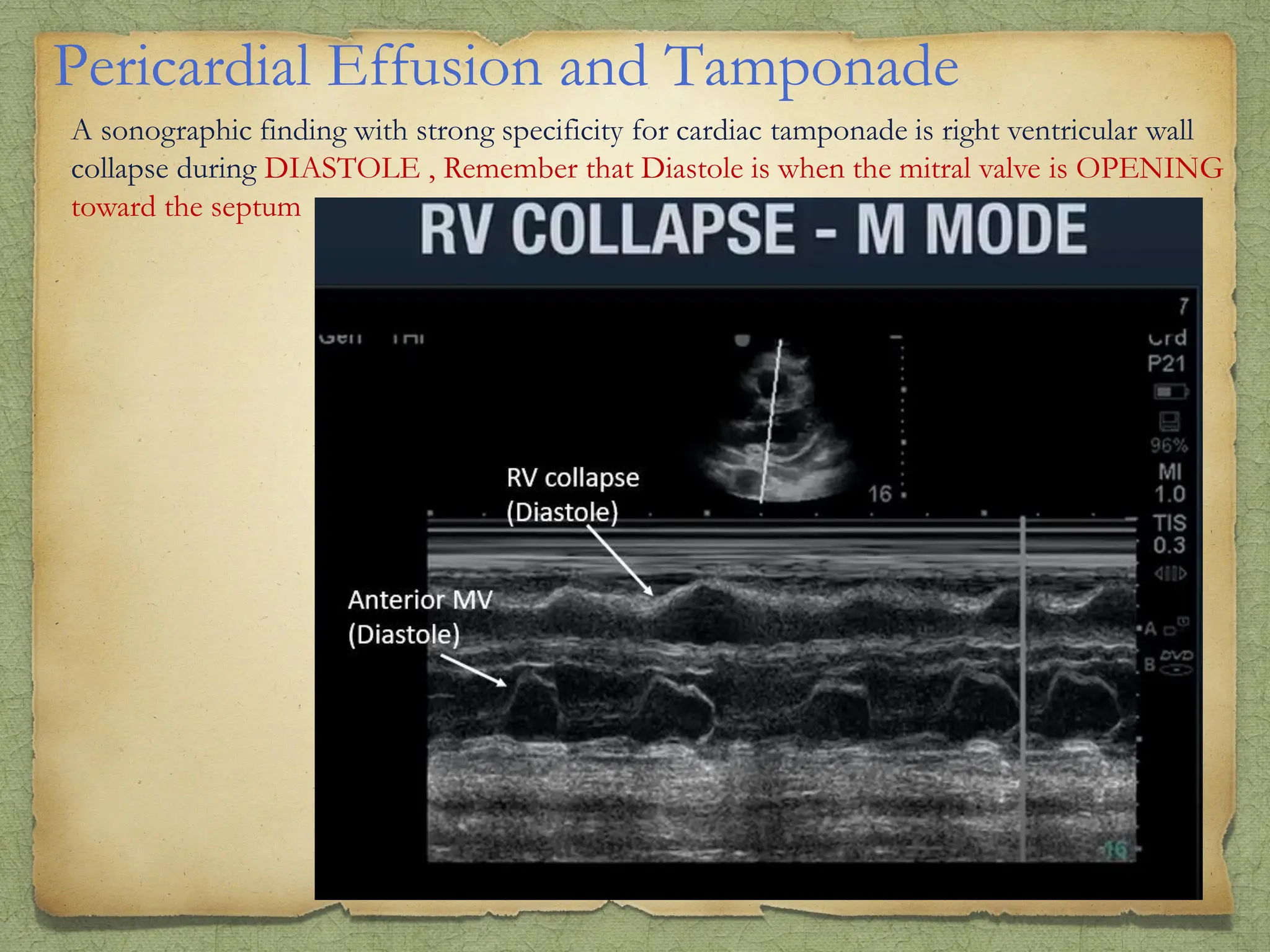 Rush Exam with Ultrasound Cases.pdf