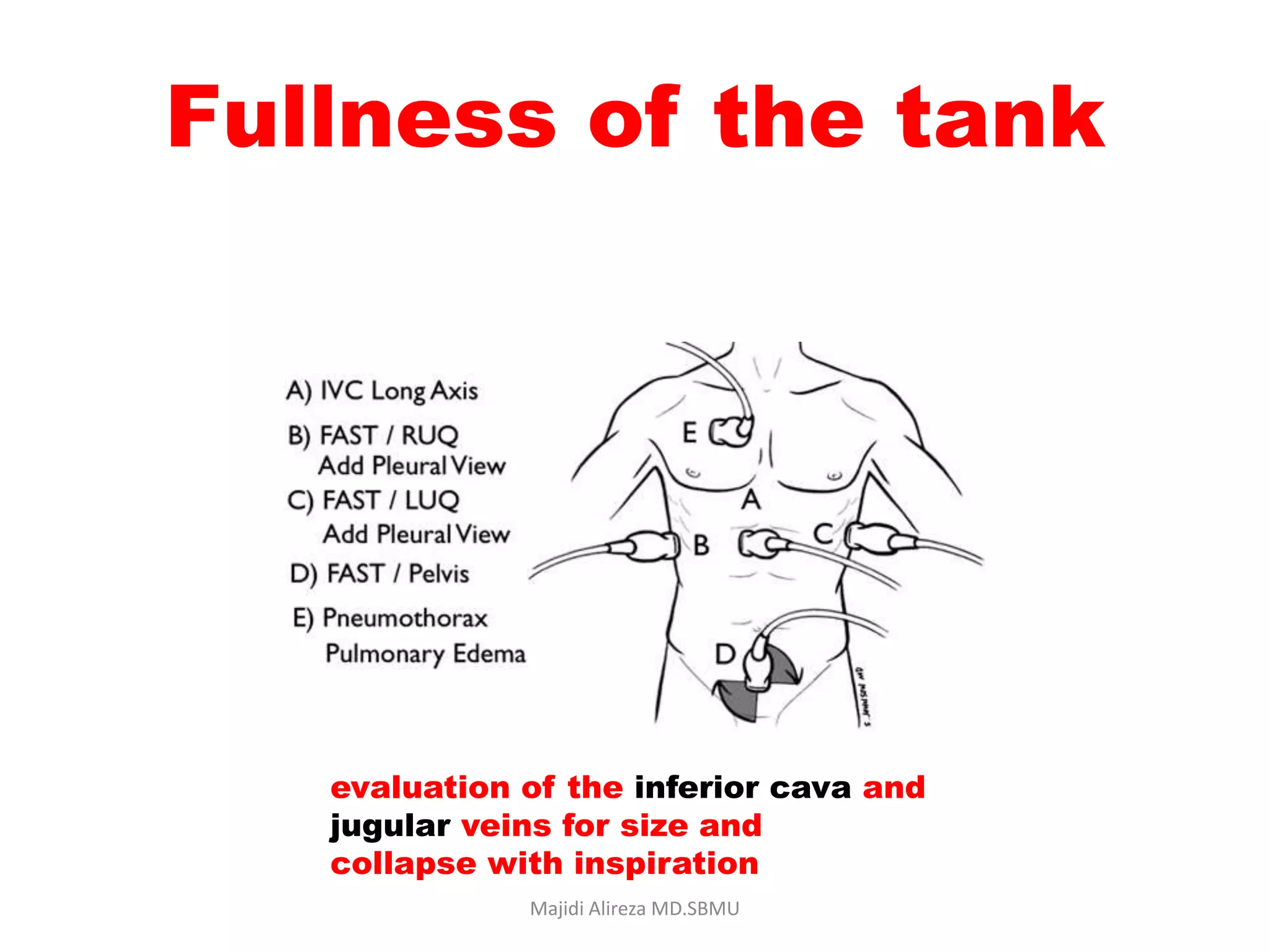 Rush protocol | PPSX