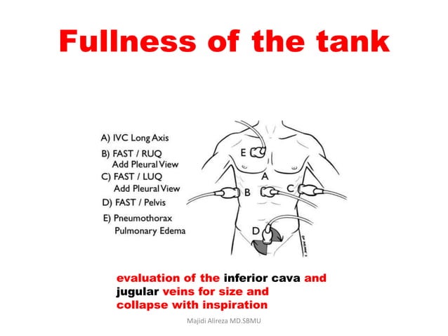 Rush protocol | PPSX