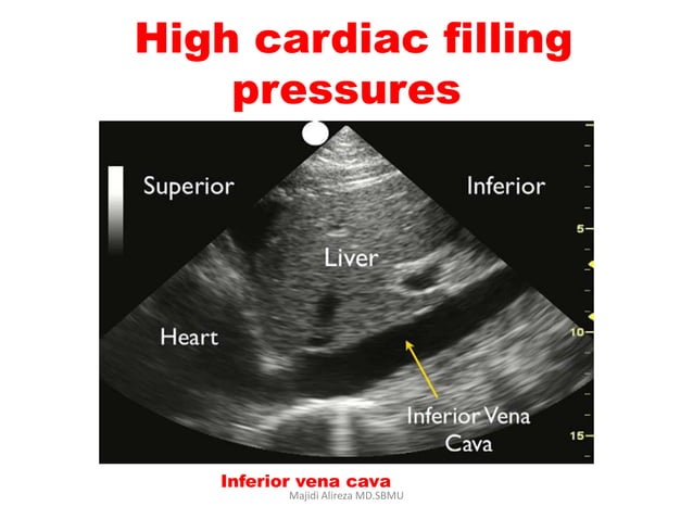 Rush protocol | PPSX
