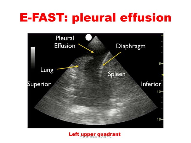 Rush protocol | PPSX
