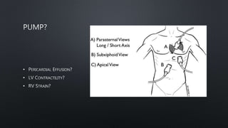 Rush protocol | PPTX