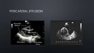 Rush protocol | PPTX