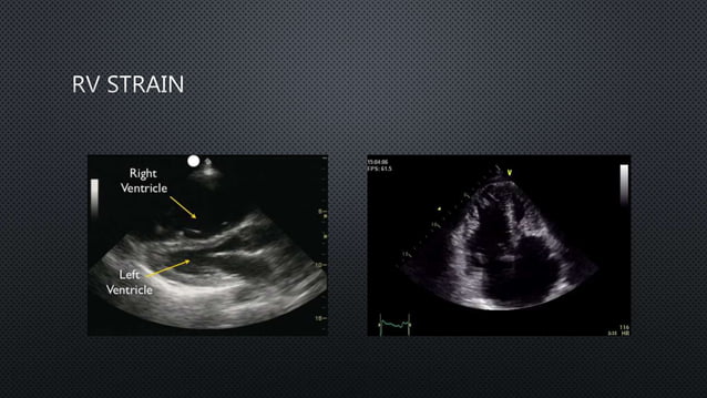 Rush protocol | PPTX