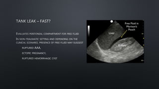 Rush protocol | PPTX