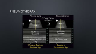 Rush protocol | PPTX
