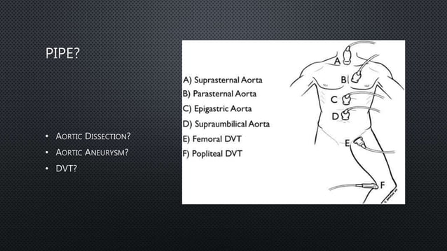 Rush protocol | PPTX