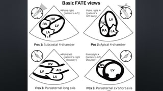 Rush protocol | PPTX