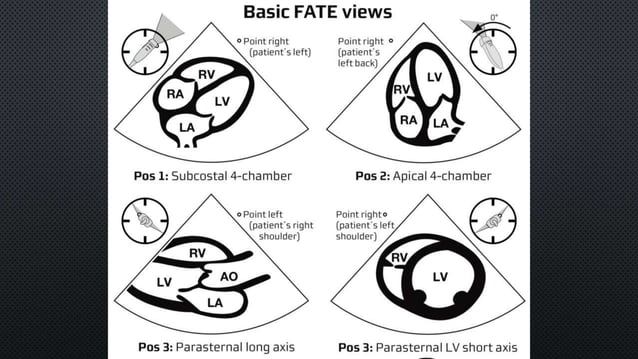 Rush protocol | PPTX