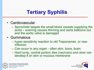 Russell Waddell: Syphilis Presentation and Treatment | PPT