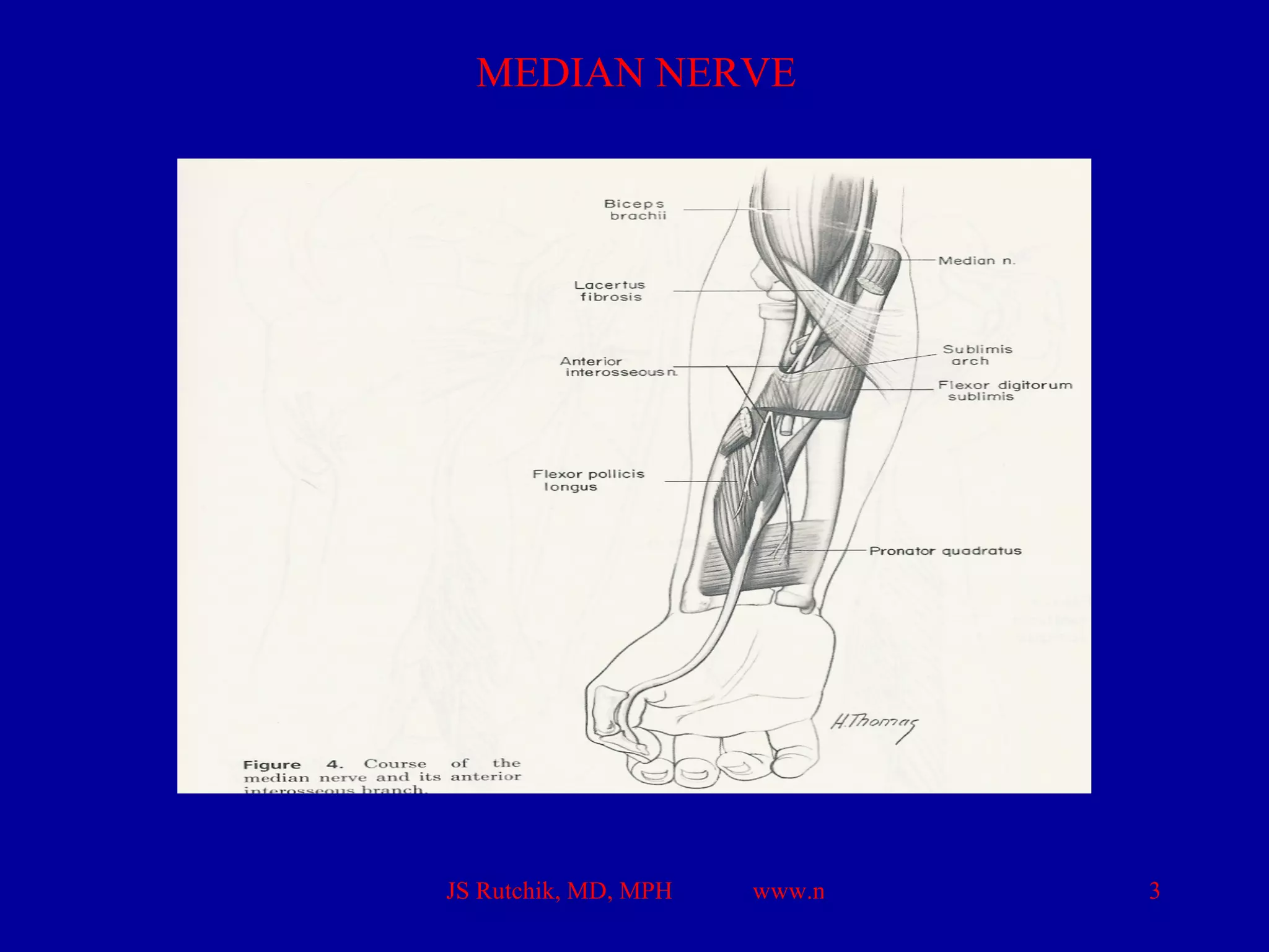 ELECTROMYOGRAPHY AND UPPER EXTREMITY DISORDERS | PPT