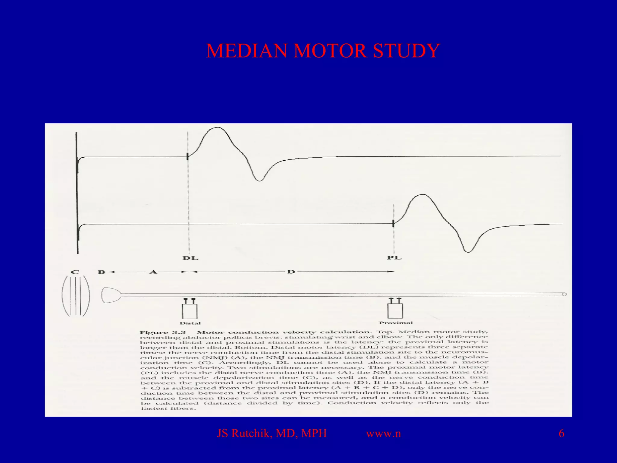 ELECTROMYOGRAPHY AND UPPER EXTREMITY DISORDERS | PPT
