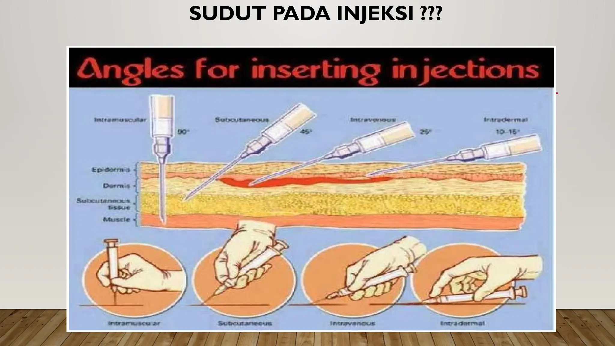 Rute Pemberian Obat Parenteral melibatkan pemberian obat ke dalam ...