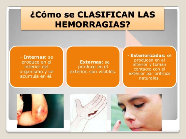 Tipos de hemorragias exteriorizadas • tiposde: hemorragias exteriorizadas pdf – Akapv
