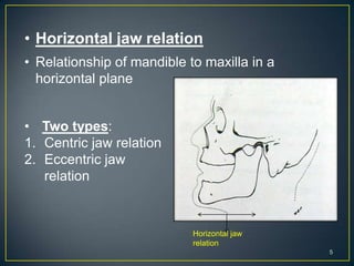 Horizontal Jaw relation | PPTX