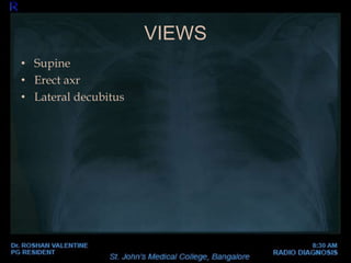 Abdominal Xrays for undergraduates | PPTX