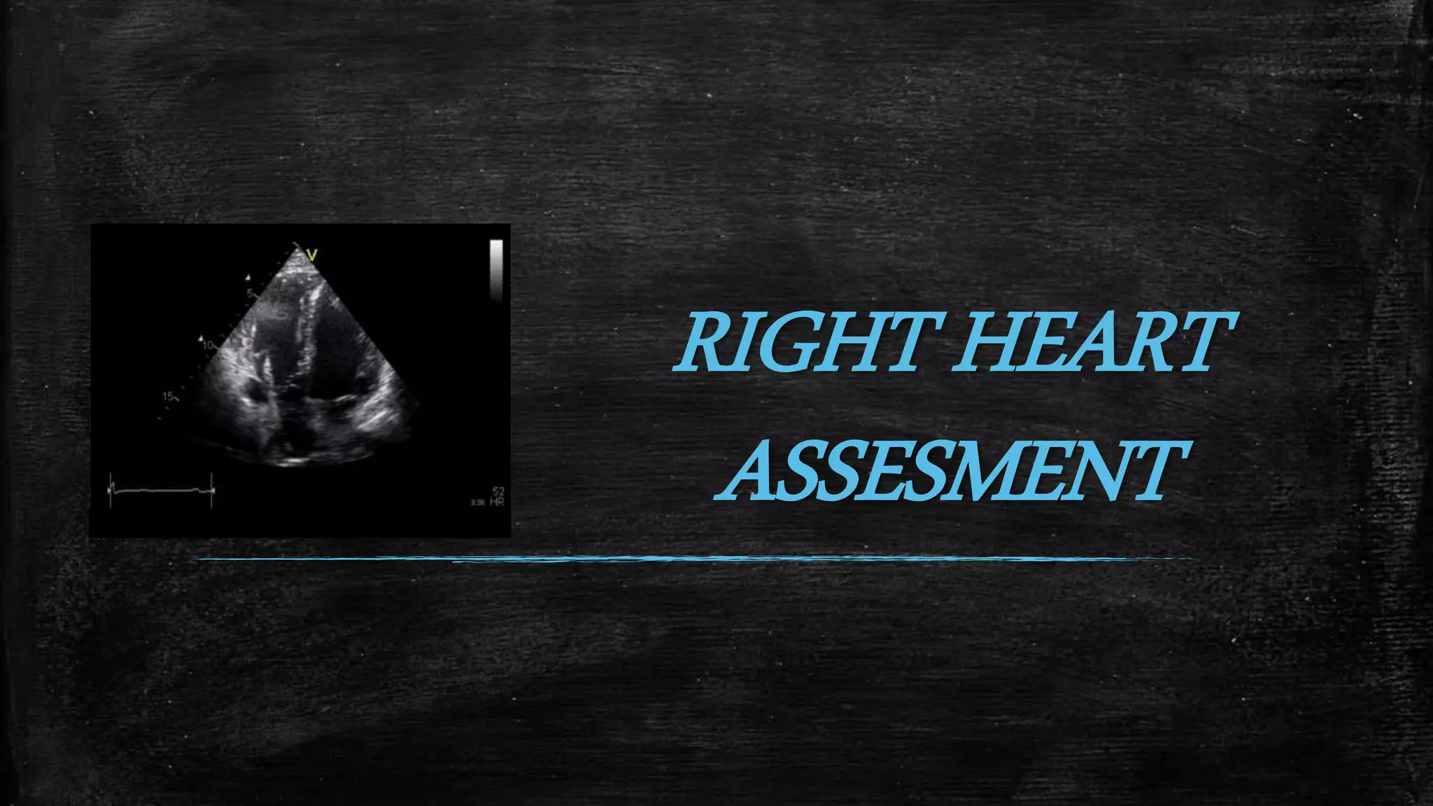 Right Ventricle Echocardiography | PPTX