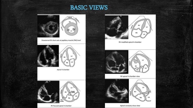 Right Ventricle Echocardiography