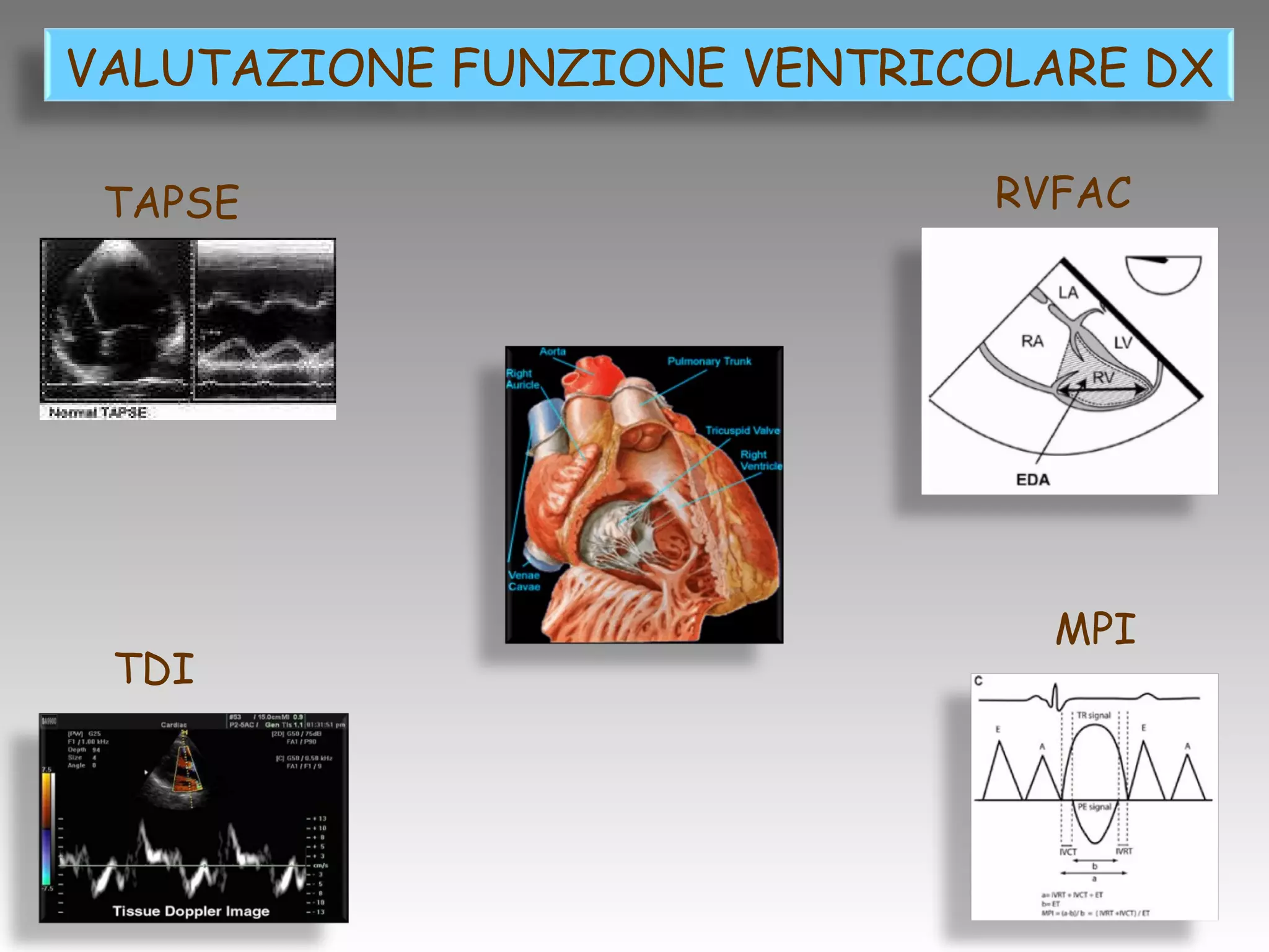 VALUTAZIONE ECOCARDIOGRAFICA del VENTRICOLO DESTRO 1 - right ventricle ...