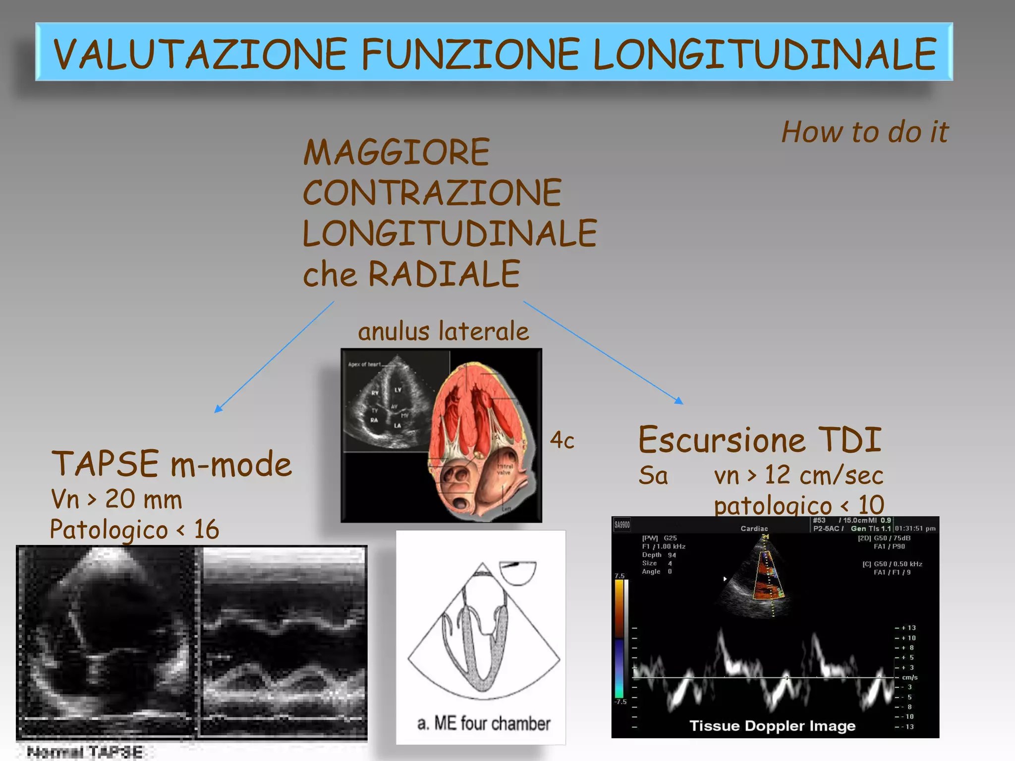 VALUTAZIONE ECOCARDIOGRAFICA del VENTRICOLO DESTRO 1 - right ventricle ...