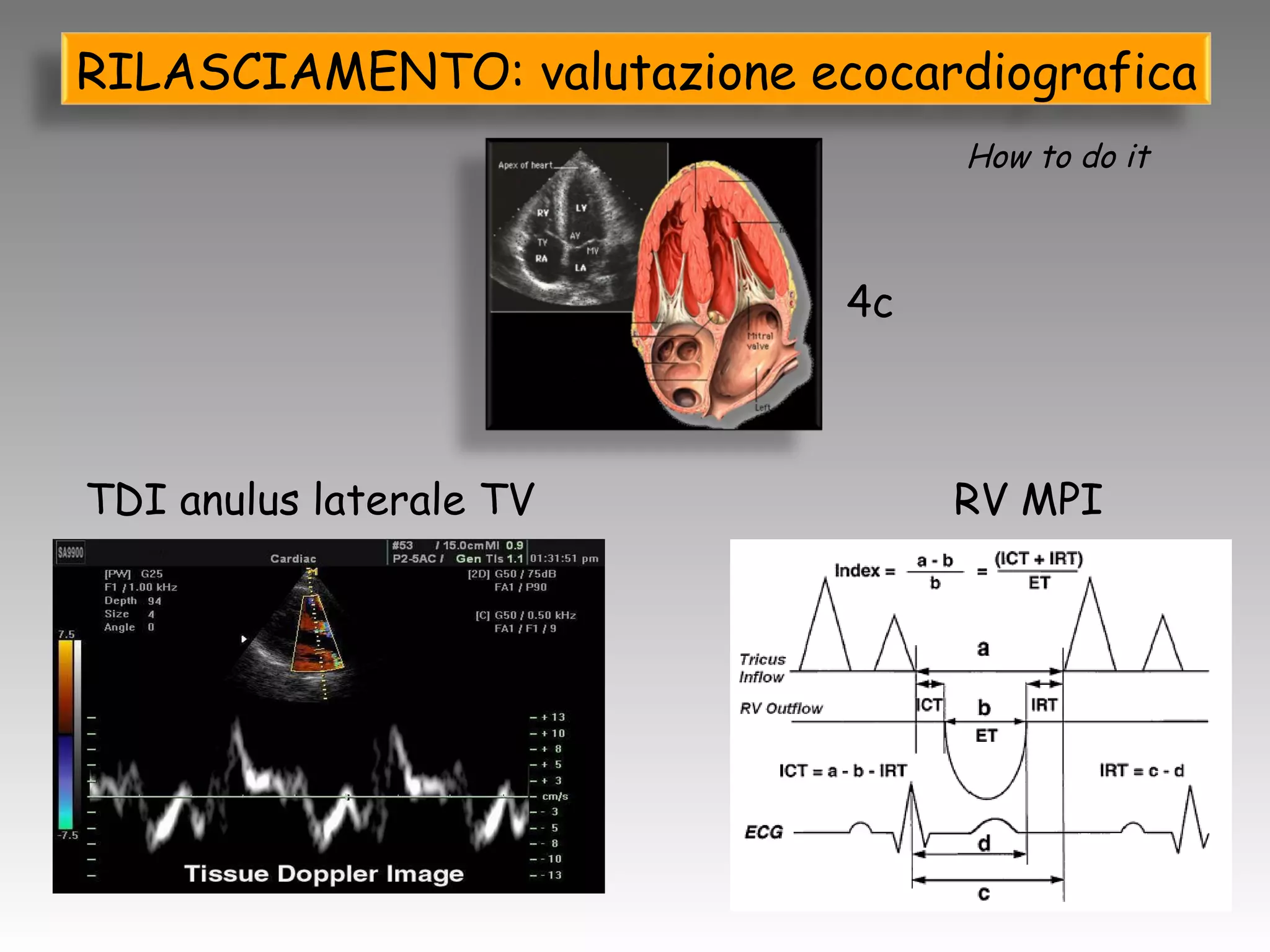 VALUTAZIONE ECOCARDIOGRAFICA del VENTRICOLO DESTRO 1 - right ventricle ...