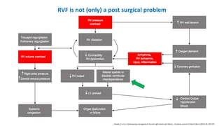 Right Ventricular Failure | PPTX