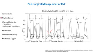 Right Ventricular Failure | PPTX