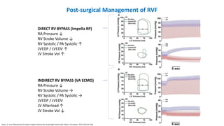 Right Ventricular Failure | PPTX
