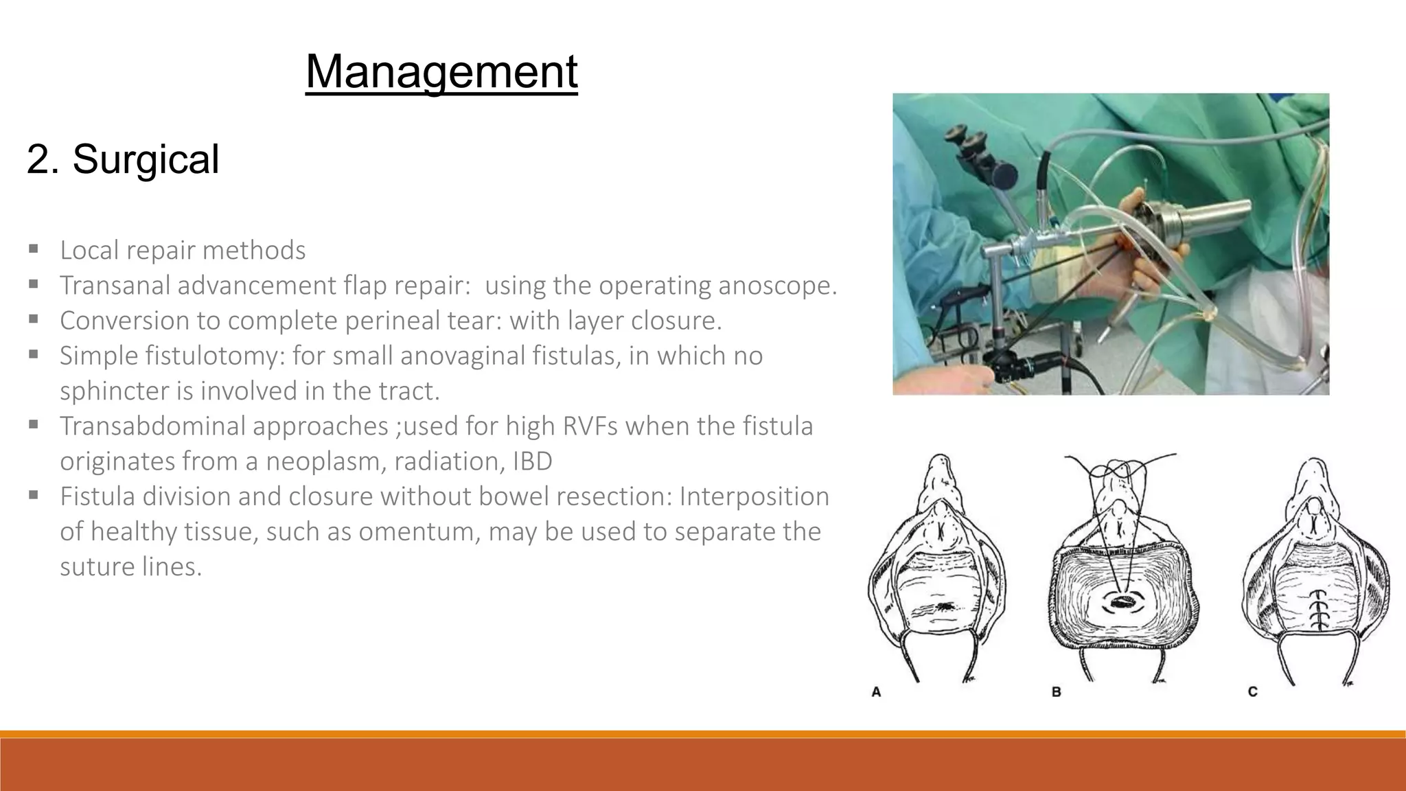 Rectovaginal fistula and Perineal tear | PPTX