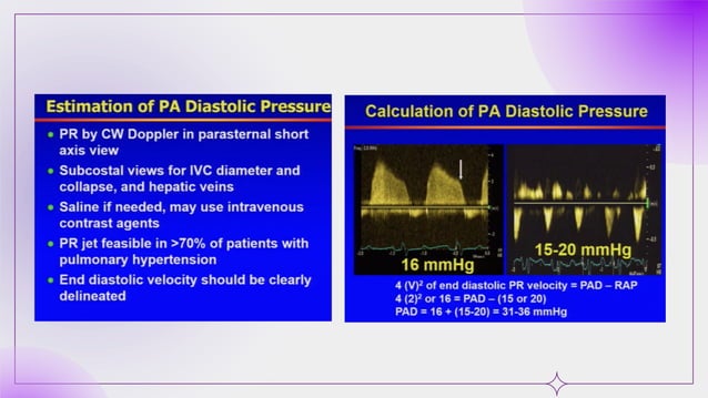 RV function assessment.pptxRV function assessment.pptx