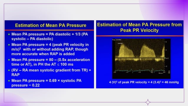 RV function assessment.pptxRV function assessment.pptx