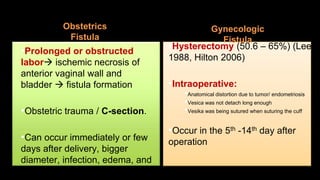 Fistula retro dan uretro vagina presentasi.pptx