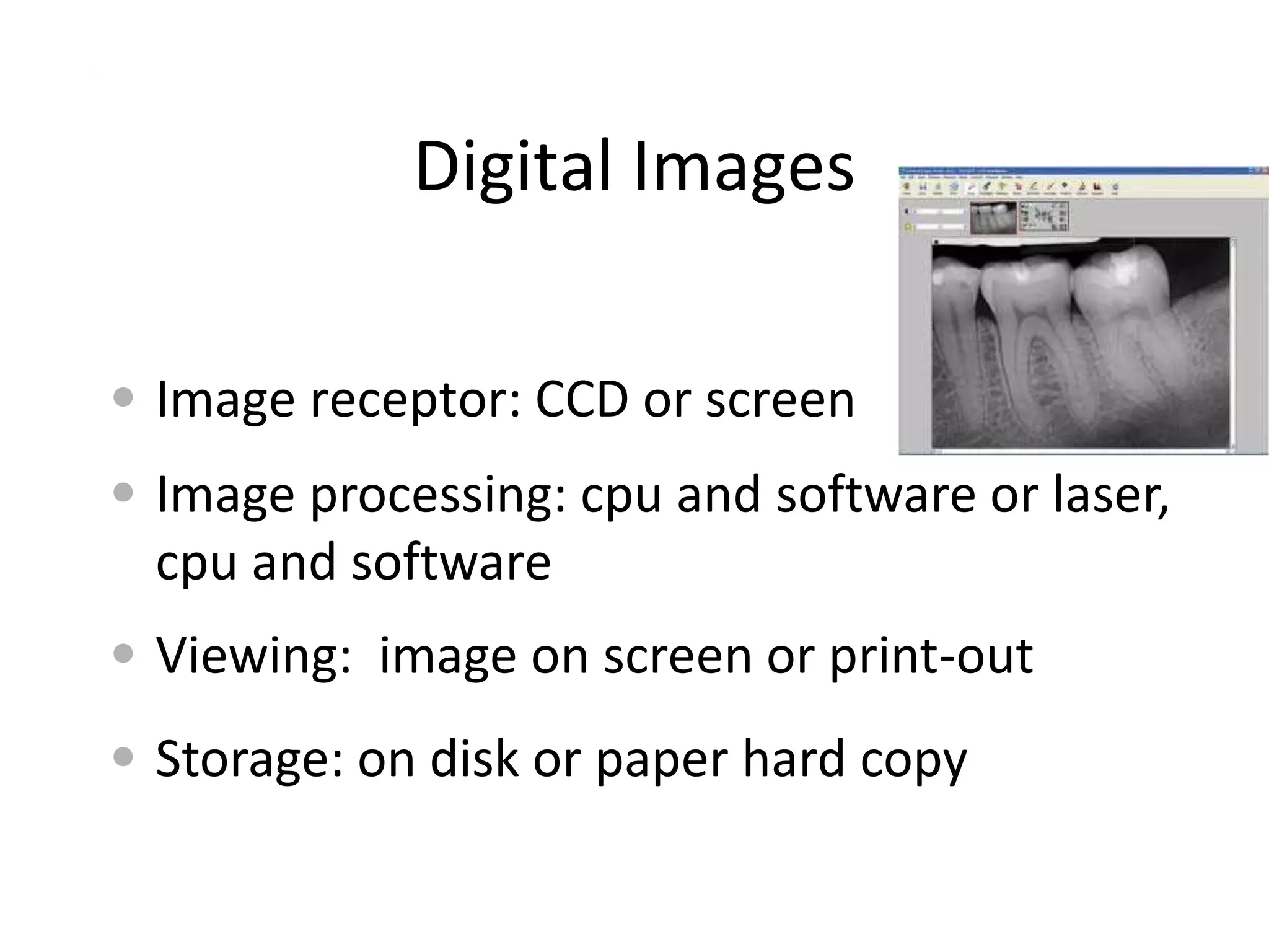 RADIO VISIO GRAPHY, Dr Anirudh Singh Chauhan | PPTX