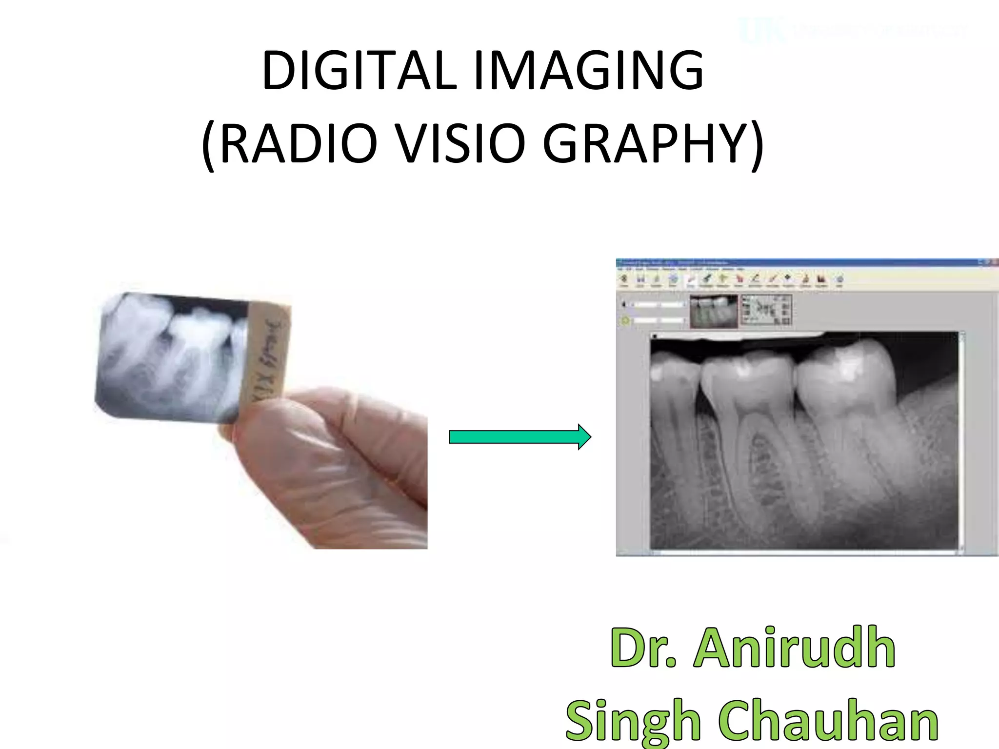 RADIO VISIO GRAPHY, Dr Anirudh Singh Chauhan | PPTX