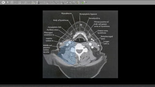 CT anatomy of Neck Spaces RV | PPTX