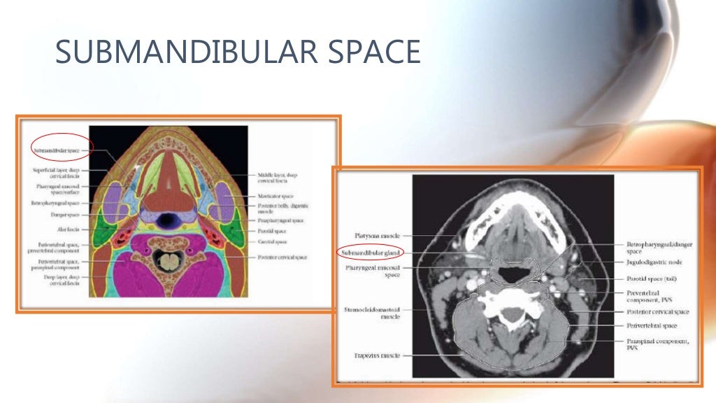 CT anatomy of Neck Spaces RV