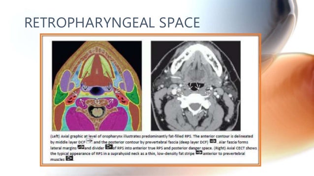 CT anatomy of Neck Spaces RV