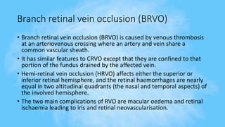 Retinal Vein Occlusion | PPTX