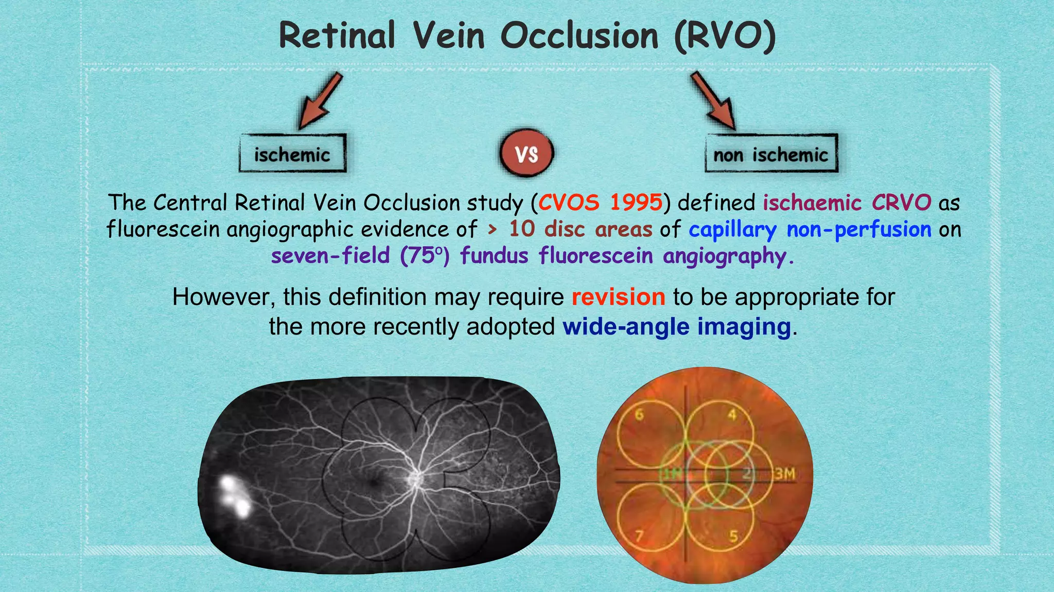 Rvo guidelines | PPTX