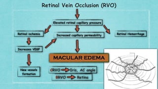 Rvo guidelines | PPT