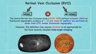 Rvo guidelines | PPT