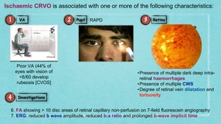 Rvo guidelines | PPT