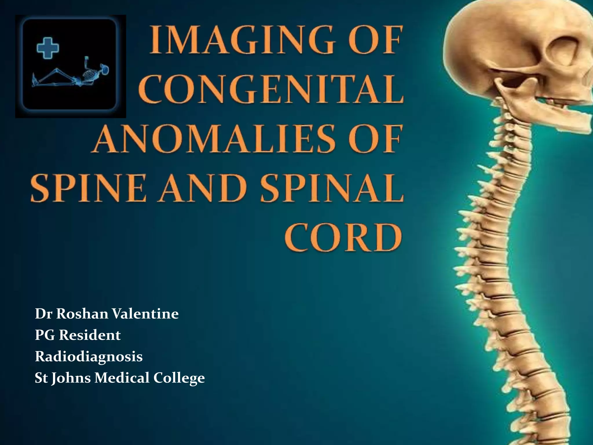 Congenital Anomalies Of Spine And Spinal Cord | PPTX