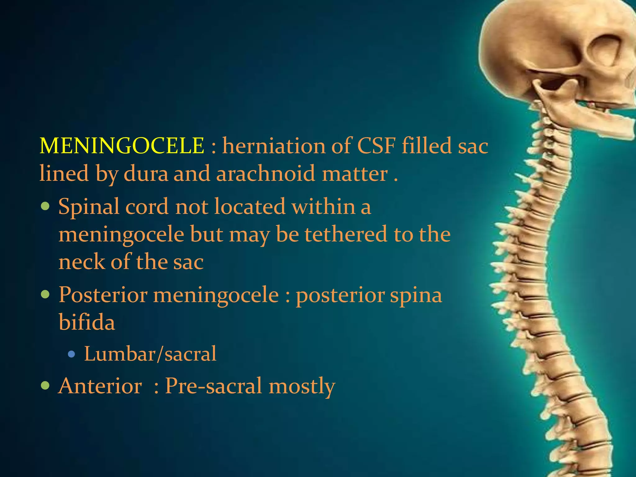 Congenital Anomalies Of Spine And Spinal Cord | PPTX | Brain and Nervous System Disorders ...