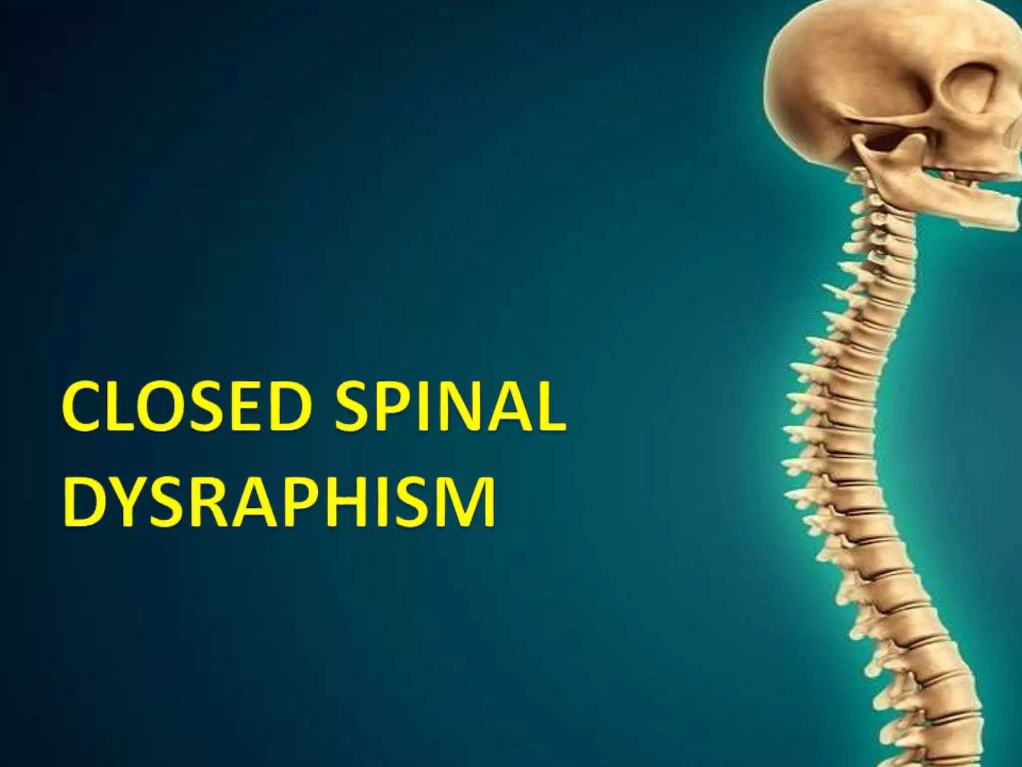 Congenital Anomalies Of Spine And Spinal Cord | PPTX