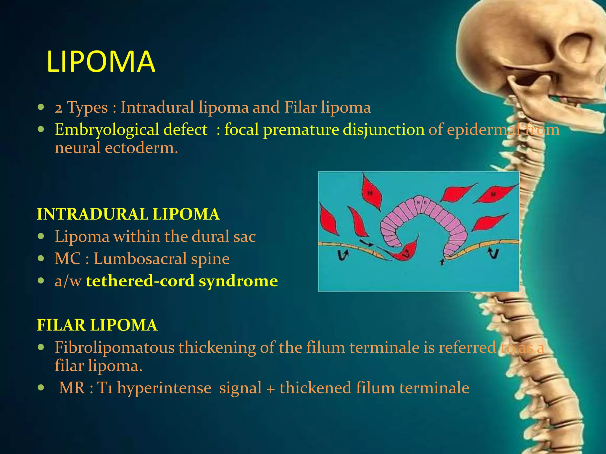 Congenital Anomalies Of Spine And Spinal Cord | PPTX